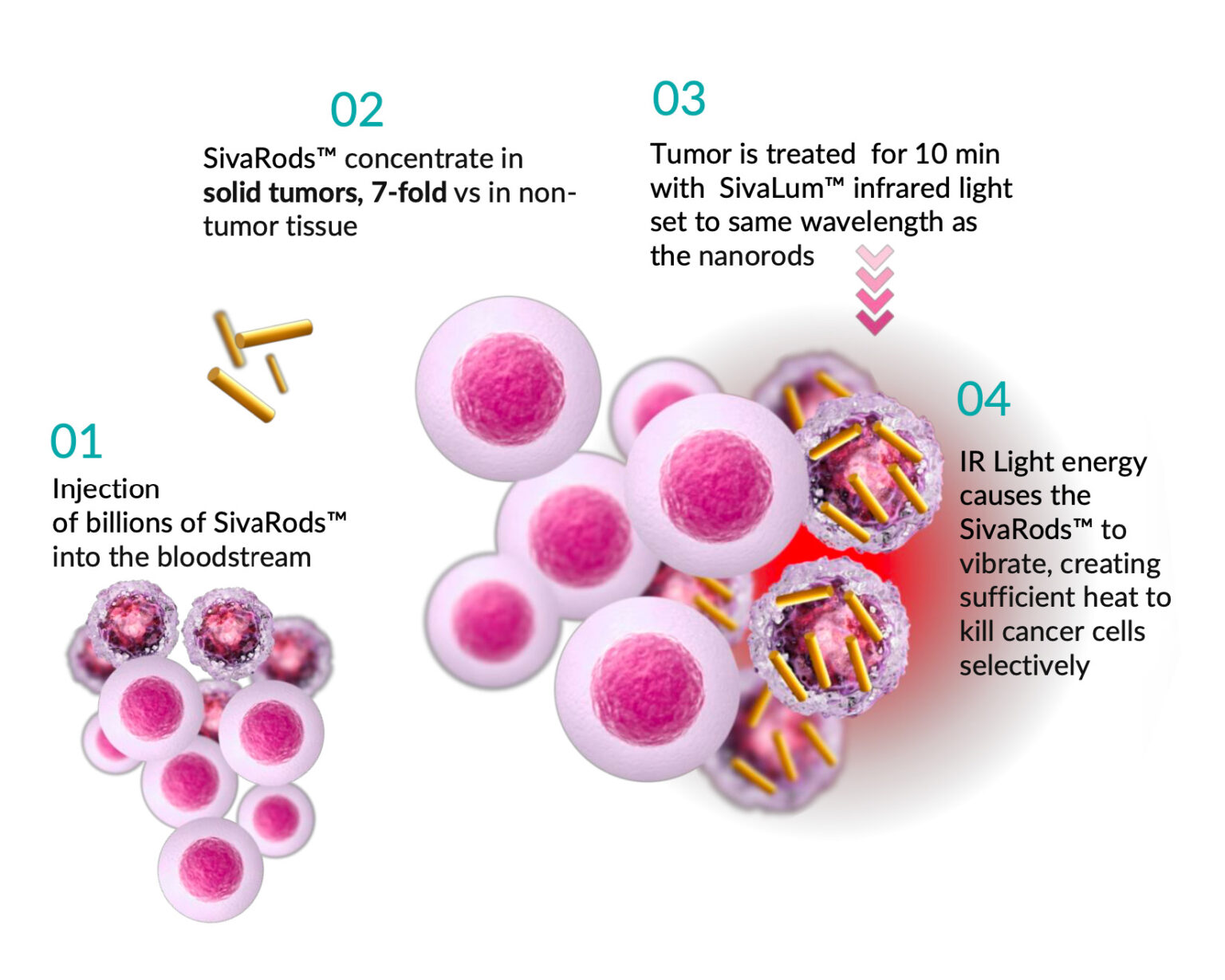 Targeted Hyperthermia Therapy (THT) - Sona Nanotech
